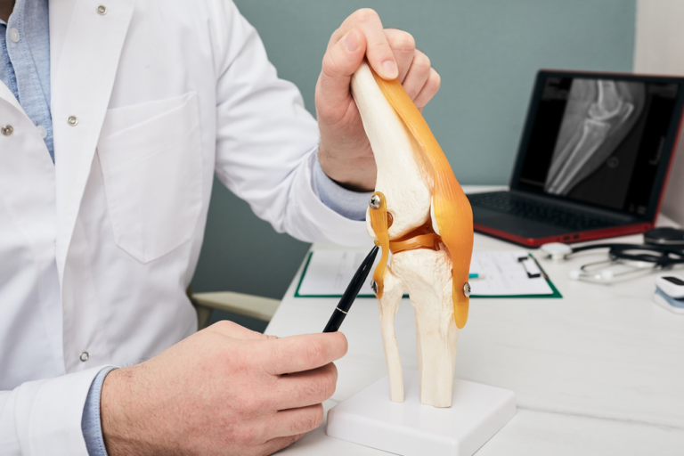 Ruptura de ligament incrucisat anterior (LIA): Cauze si tratament ...