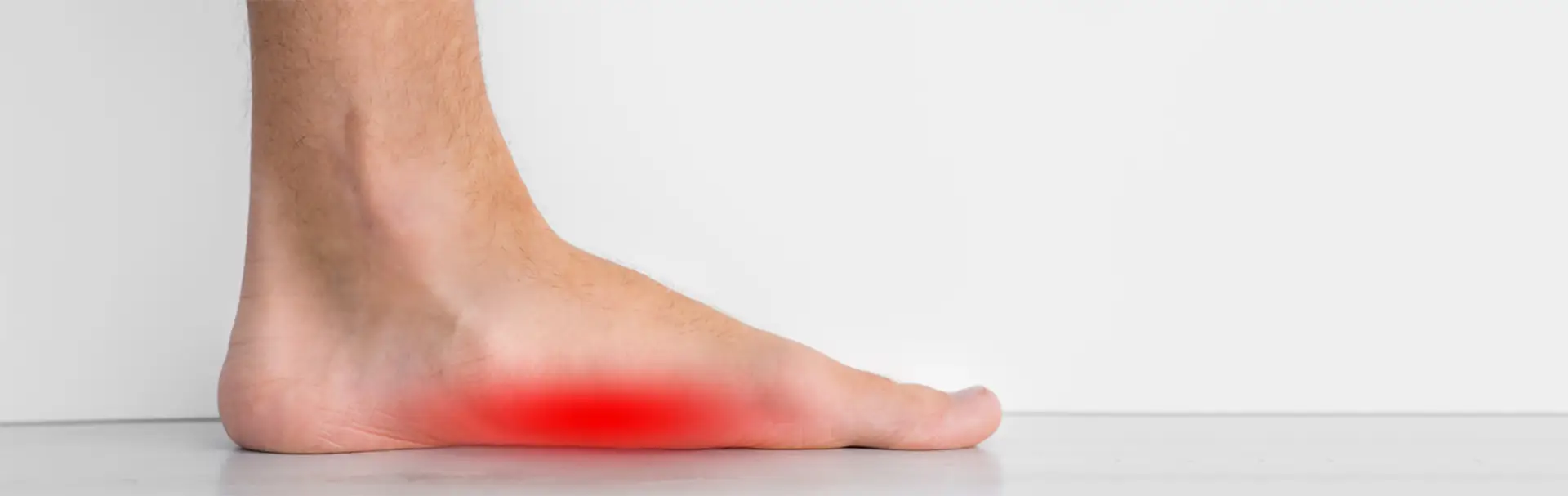 Platfusul: simptome, diagnostic, tratament | Afectiuni tratate Kinetic.ro