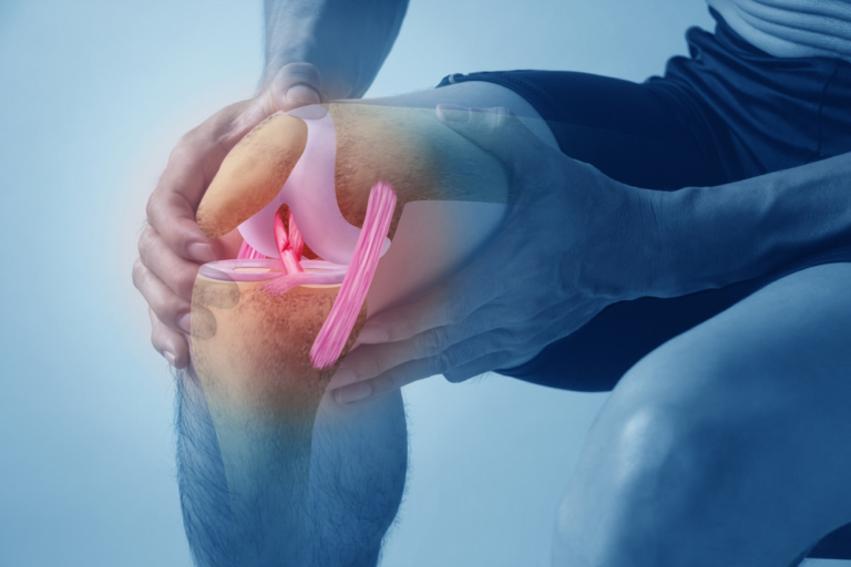 Ruptura de ligament incrucisat anterior (LIA): Cauze si tratament ...