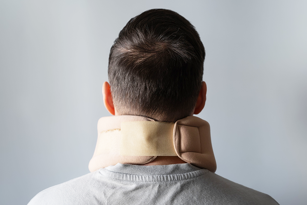 Fractura cervicala: simptome, cat dureaza vindecarea | Kinetic.ro